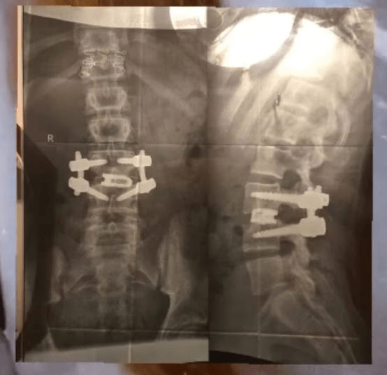 Elena Eremina Was a Rare One-Hit Wonder – An Old School Gymnastics Blog